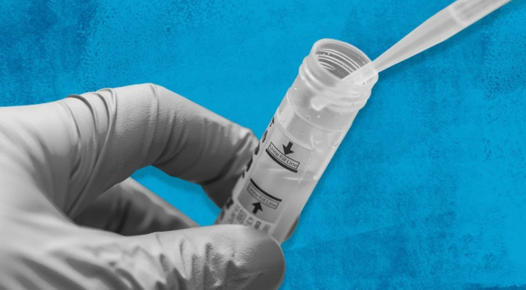 Trichomoniasis: Diagnosis and Treatment Options for Men and Women