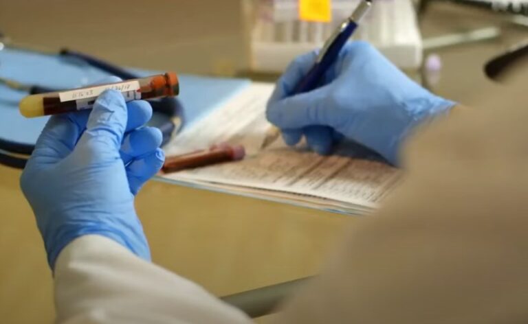 HIV ELISA Test And HIV ECLIA Test: The Power of Accuracy