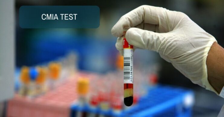HIV antigen detection Archives - Dr. Tan and Partners