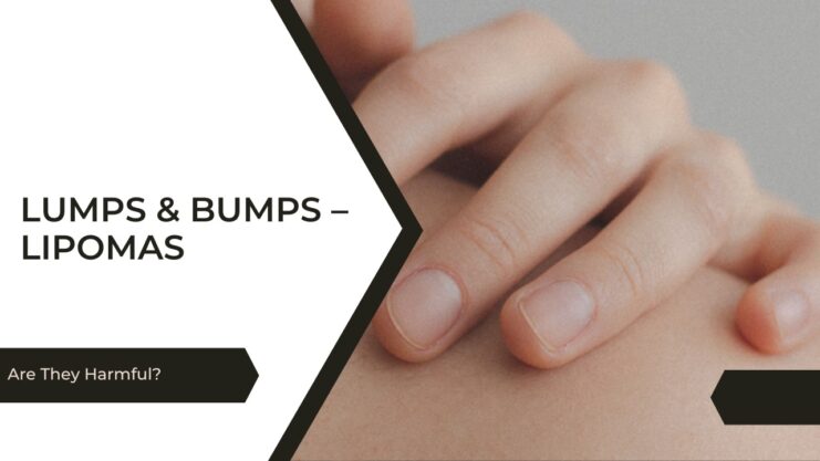 Lipomas: Common Lumps & Bumps – Closer Look at Your Body