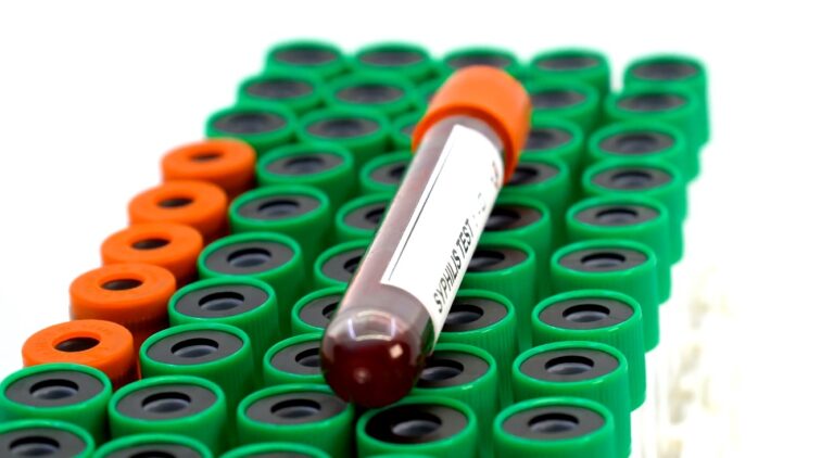 The Different Stages of Syphilis Infection and the Symptoms