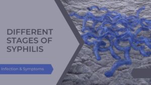 The Different Stages of Syphilis Infection and the Symptoms