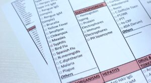 The Different Stages of Syphilis Infection and the Symptoms