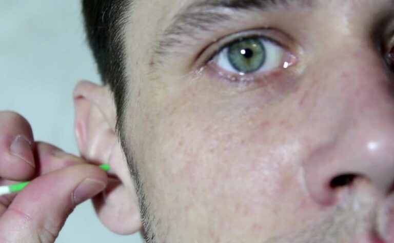 Otitis Externa: A Comprehensive Guide to Prevention and Treatment